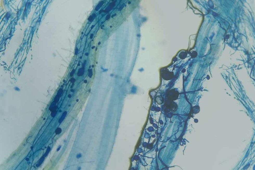 Bagaimana Cara Mikoriza Menginfeksi Akar Tanaman? | PT Anugerah Sarana ...