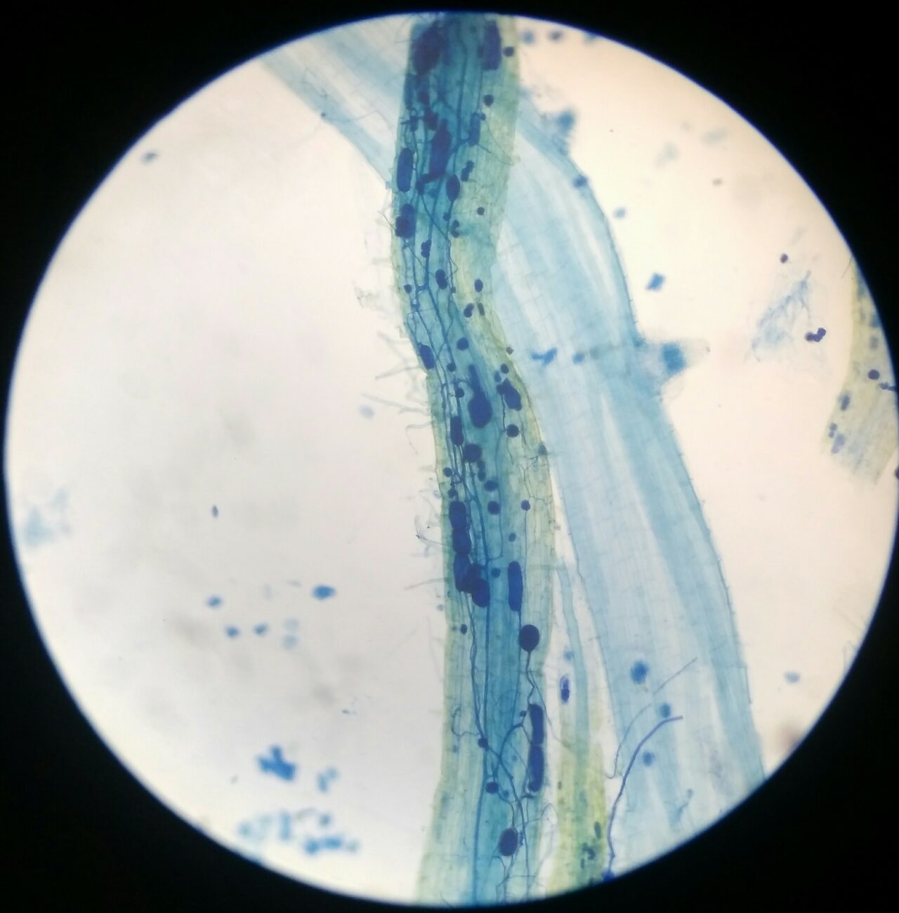 Mikoriza; Arti & Manfaatnya Bagi Tanaman | PT Anugerah Sarana Hayati